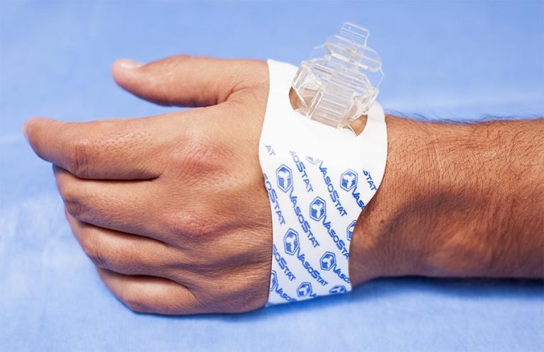 Forge Medical & VasoStat Hemostasis Device